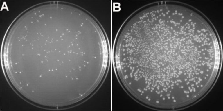 T4 DNA Ligase – Tinzyme